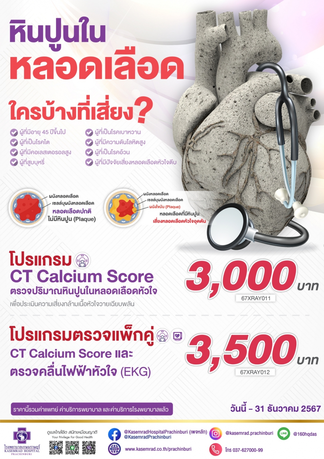 Kasemrad Hospital | Packages & Promotions -> โปรแกรม CT Calcium Score